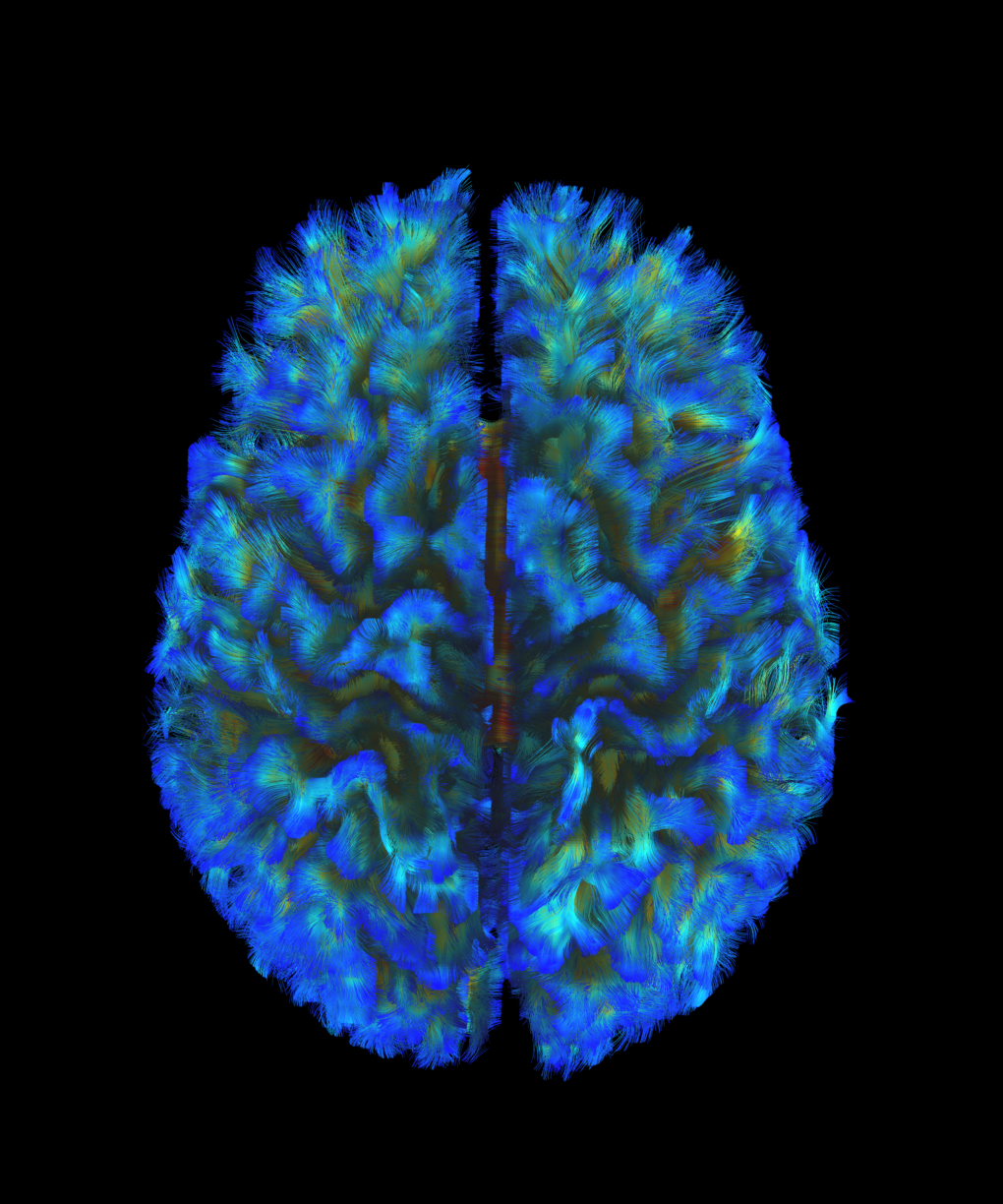 LIFE Brain Project | UAMS Helen L. Porter and James T. Dyke Brain ...