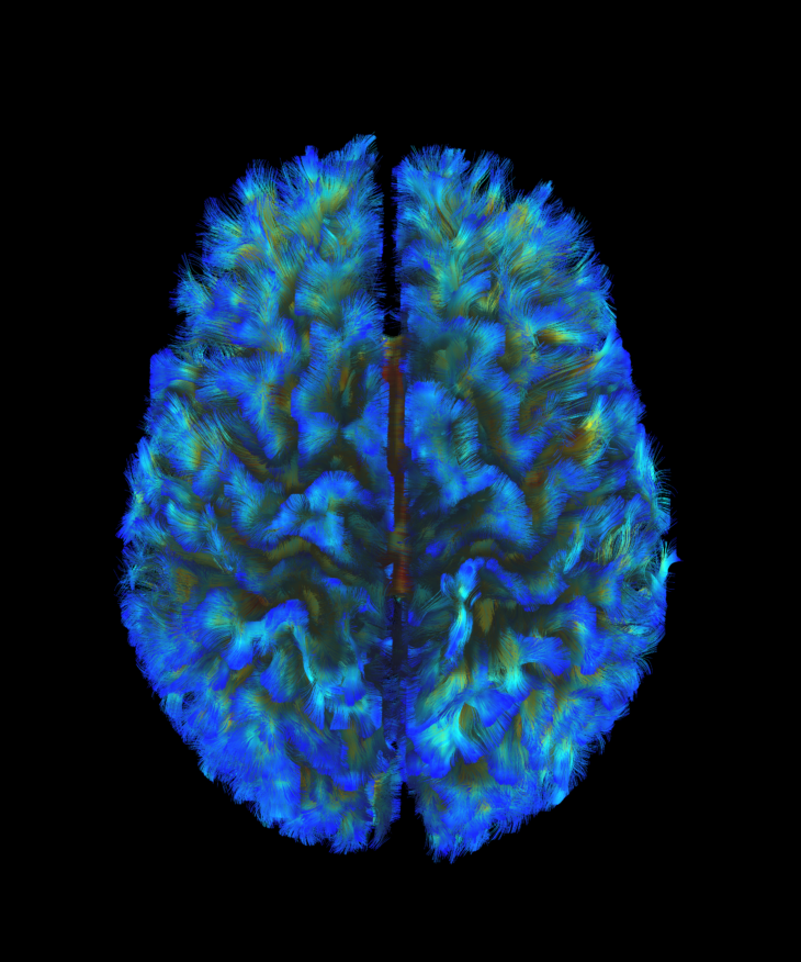 LIFE Brain Project | UAMS Helen L. Porter and James T. Dyke Brain ...